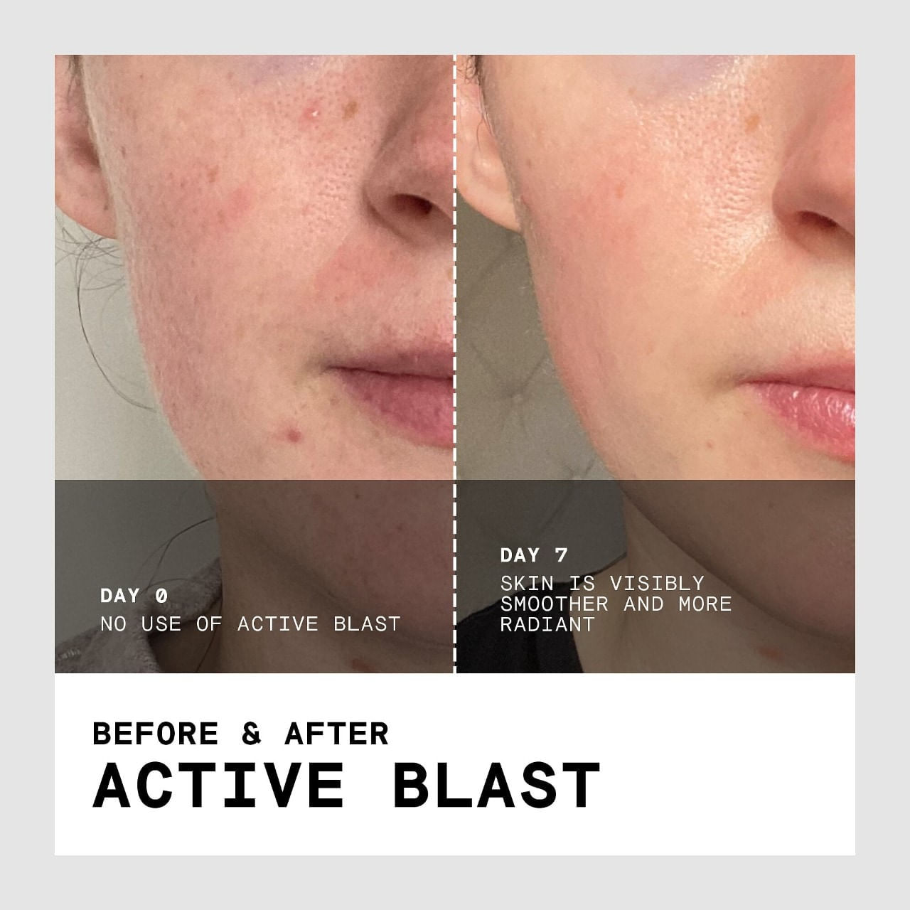 Active Blast Concentrated Collagen Daily Treatment | SHOP BAZAAR
