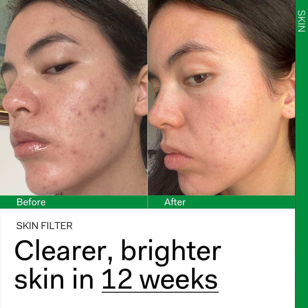 Skin Filter Serum & Supplement Duo Irritation-free Retinol Solution ...