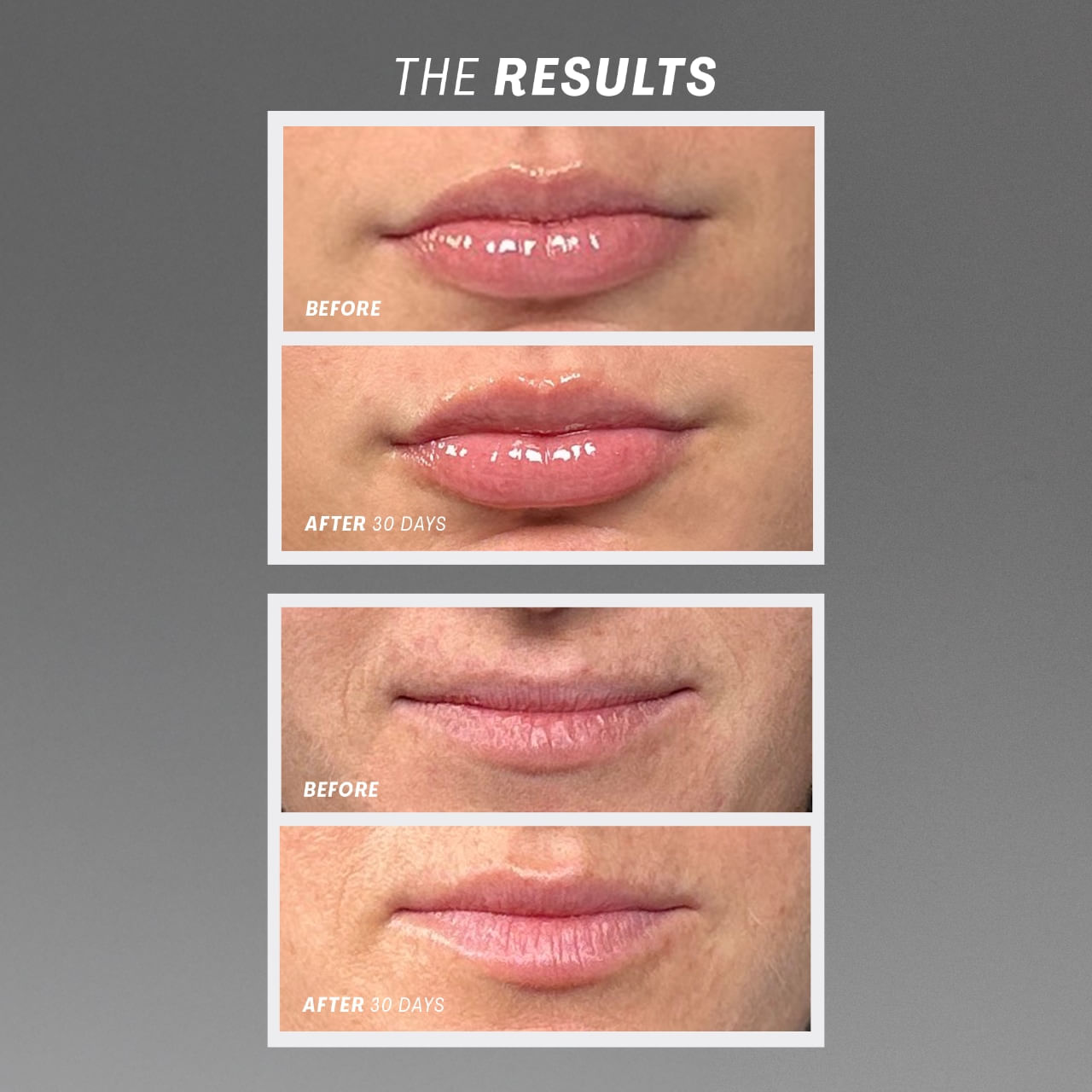 Lip Oasis™ Glossy Treatment | SHOP BAZAAR